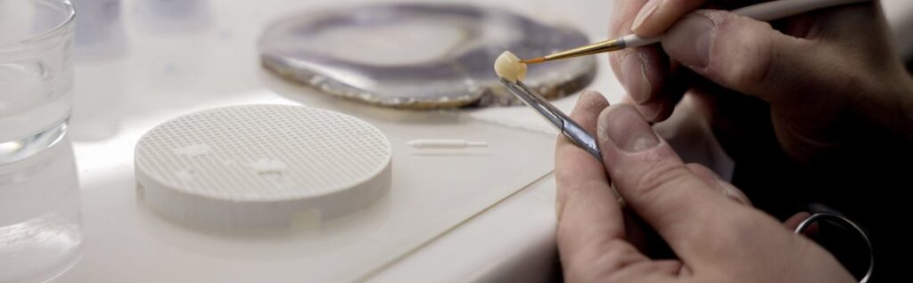 Portfolio News: ALS Dental welcomes Fident Implant Dental Laboratory ...